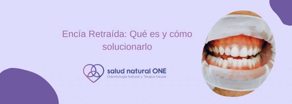 Encía Retraída: qué es y cómo solucionarlo - Salud Natural One